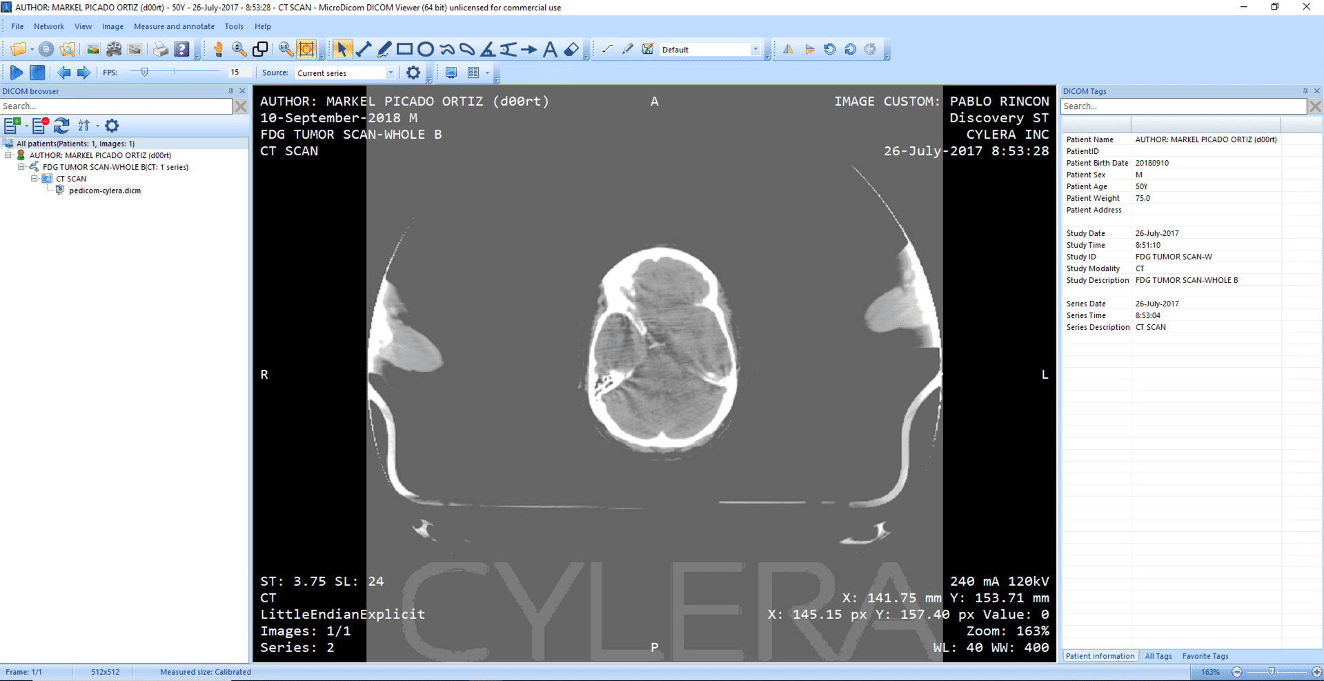 Gaining X-Ray Vision: Preventing healthcare cyberattacks with LogRhythm - Security Boulevard